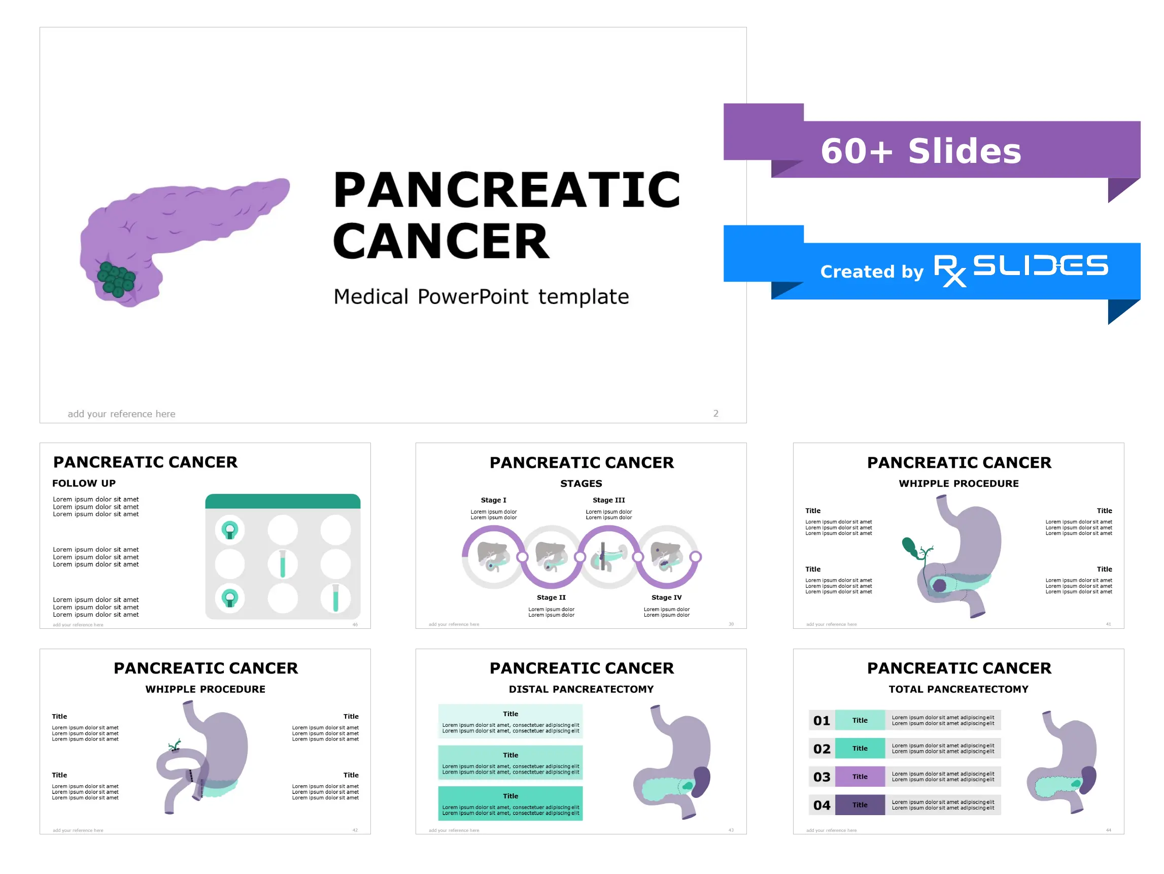 Download Pancreatic Cancer PowerPoint Template|